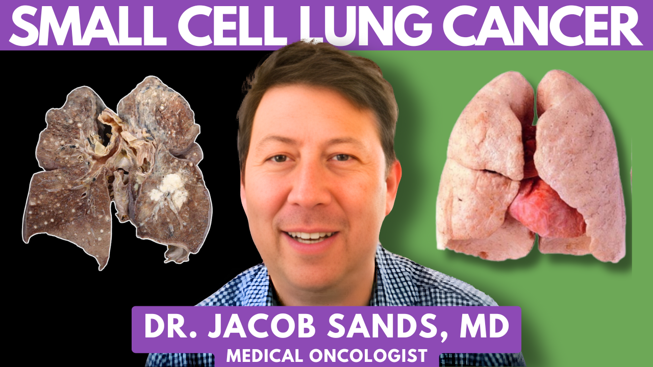 Small Cell Lung Cancer Treatment - Dr. Jacob Sands, MD - OncologyTube